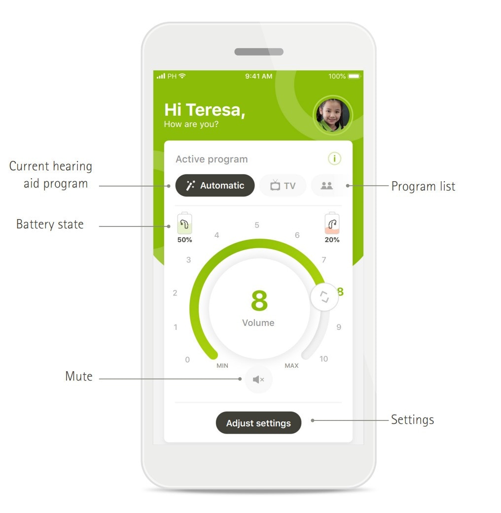 Phonak CROS Lumity Overview | PhonakPro