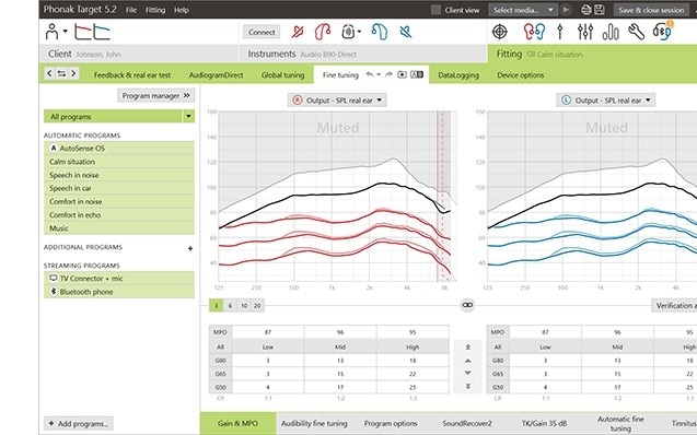 Learn more about AutoSense OS | PhonakPro
