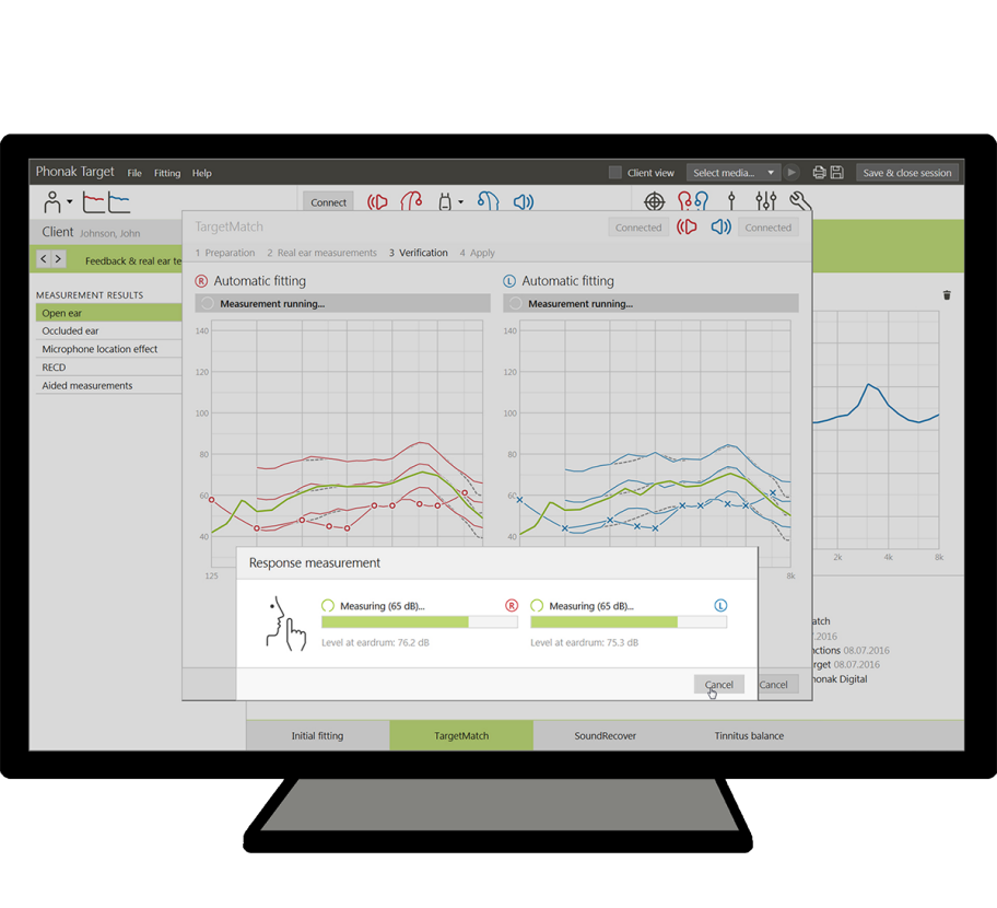 Phonak TargetMatch Overview | PhonakPro