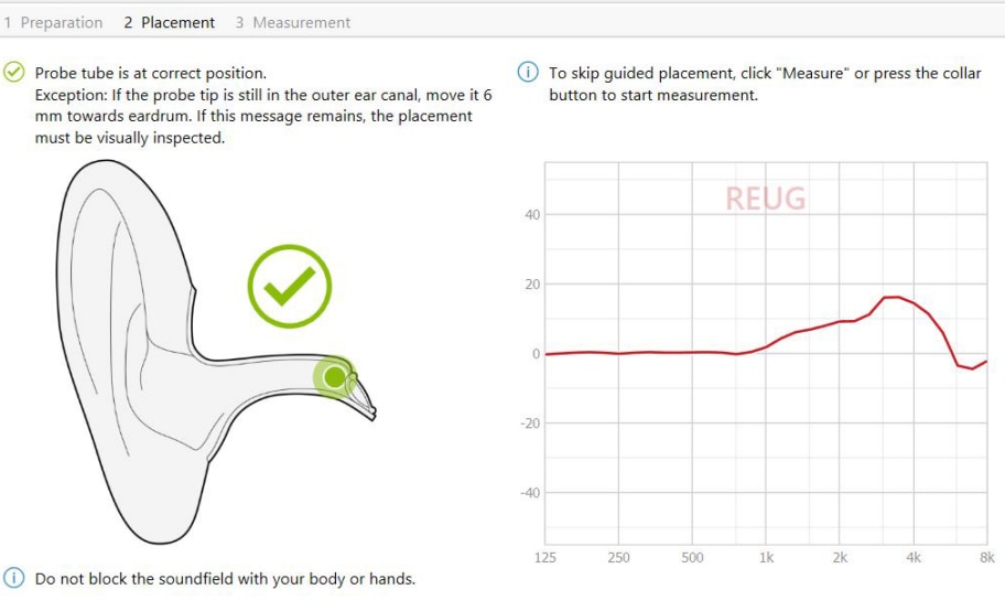 Phonak TargetMatch Overview | PhonakPro