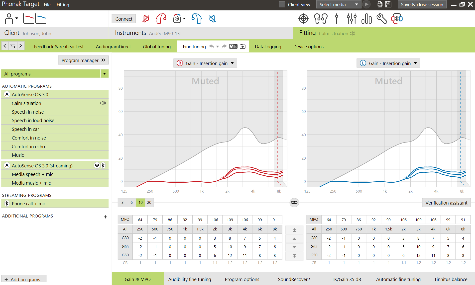 Funciones de Phonak Target | PhonakPro