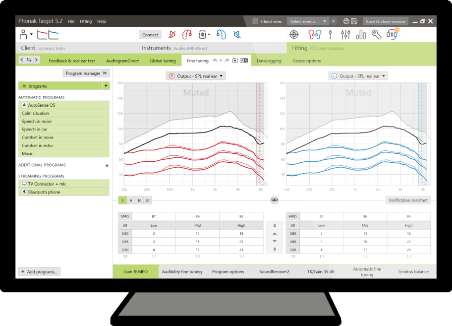 Descripción general de Phonak Target | PhonakPro